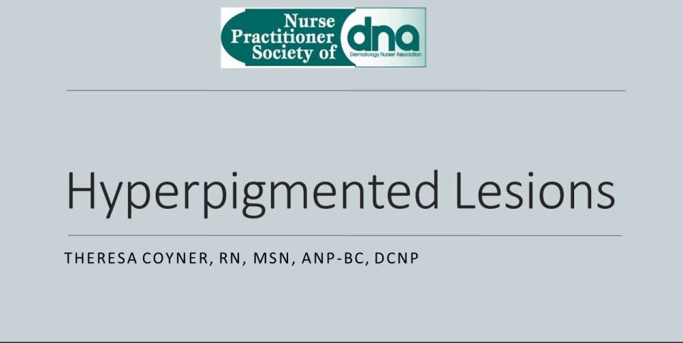 NPS Case Studies - #2